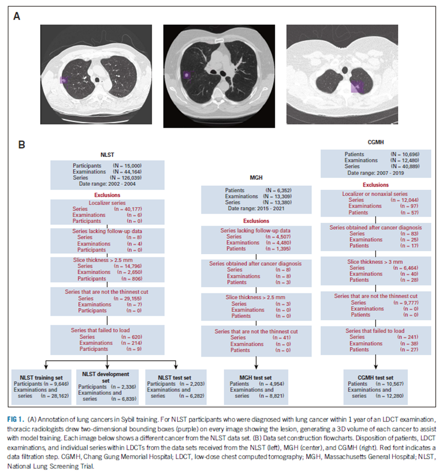 Sybil：基于单次LDCT预测未来肺癌风险的深度学习模型