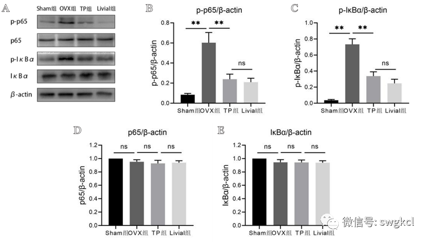 荐读 | 雷公藤甲素对去势小鼠骨质疏松模型破骨细胞分化的影响